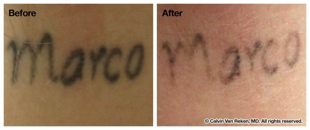 Photo Gallery Reno NV - Reno Sparks Medspa